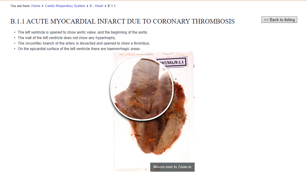 Faculty of Medicine, University of Kelaniya - Pathology Museum